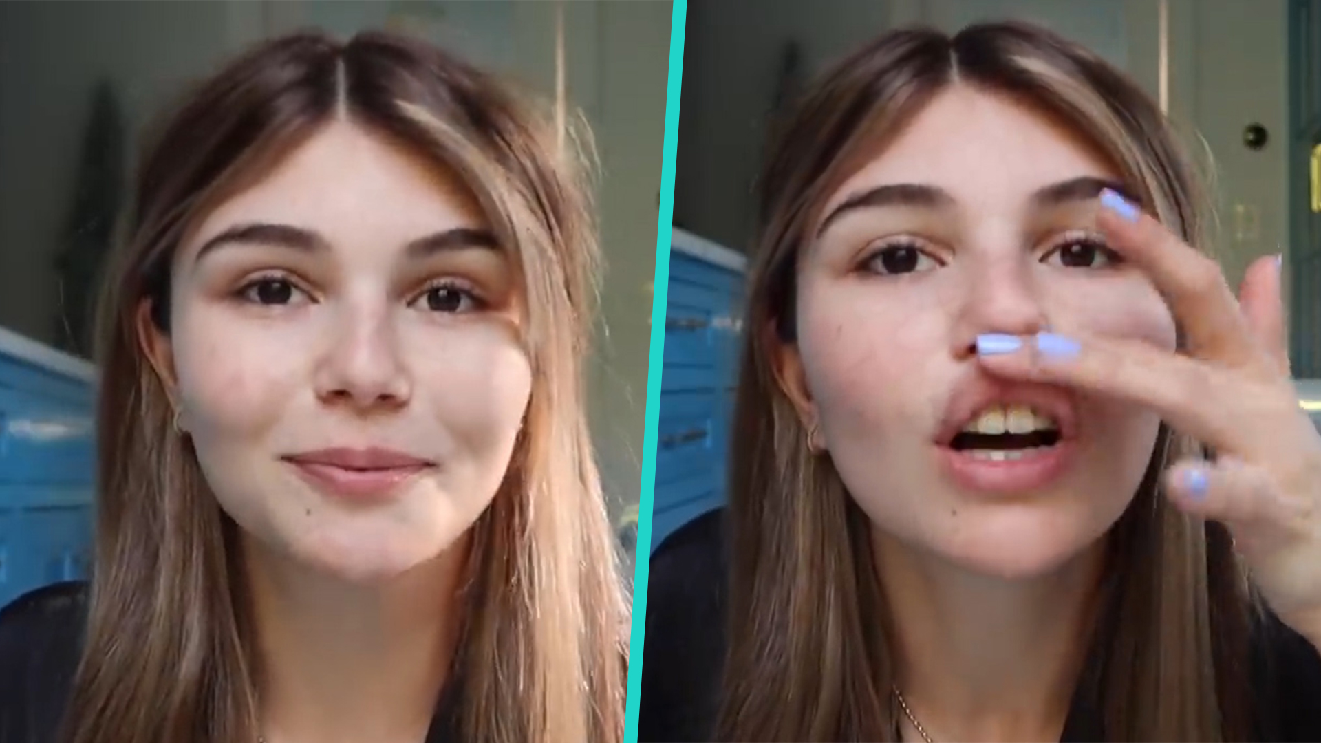 Olivia Jade Giannulli Splits Lip & Chips Tooth After Fainting In Her ...