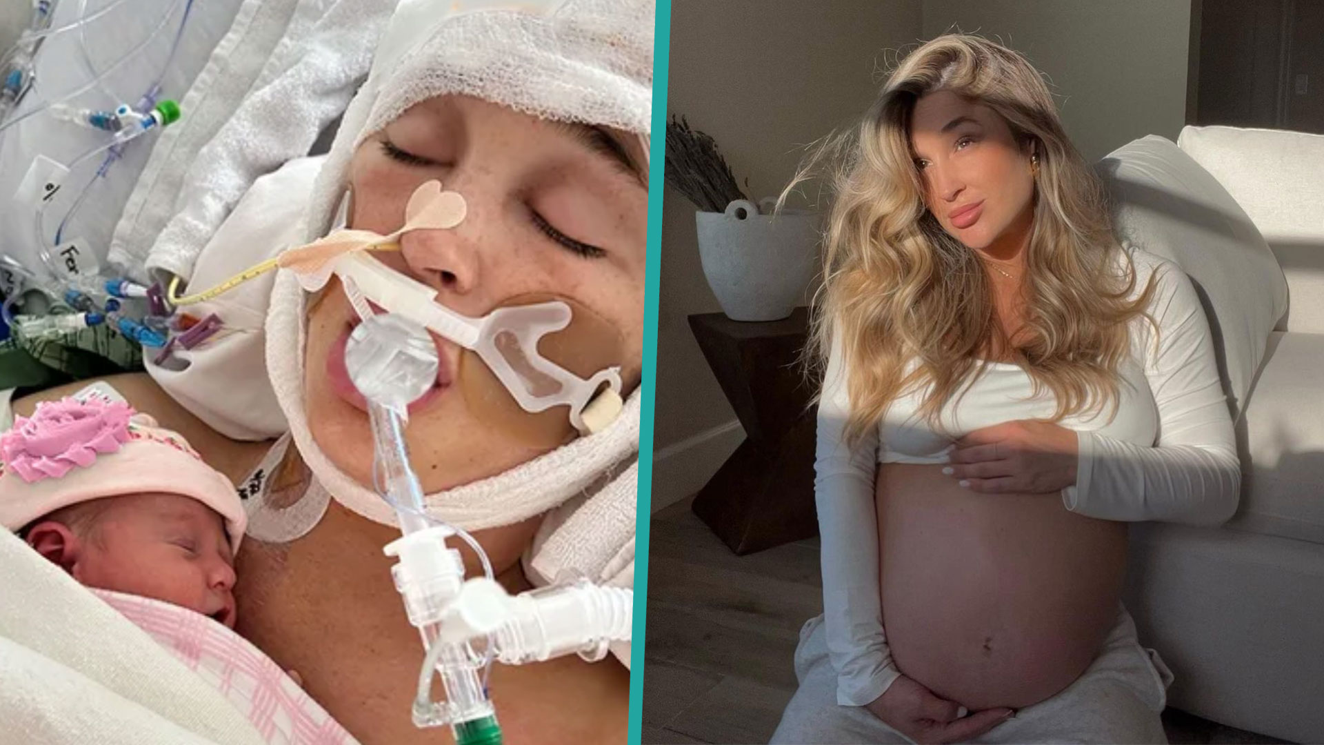 Influencer Jackie Miller James In Coma After Suffering Brain Aneurysm At 9 Months Pregnant | Access