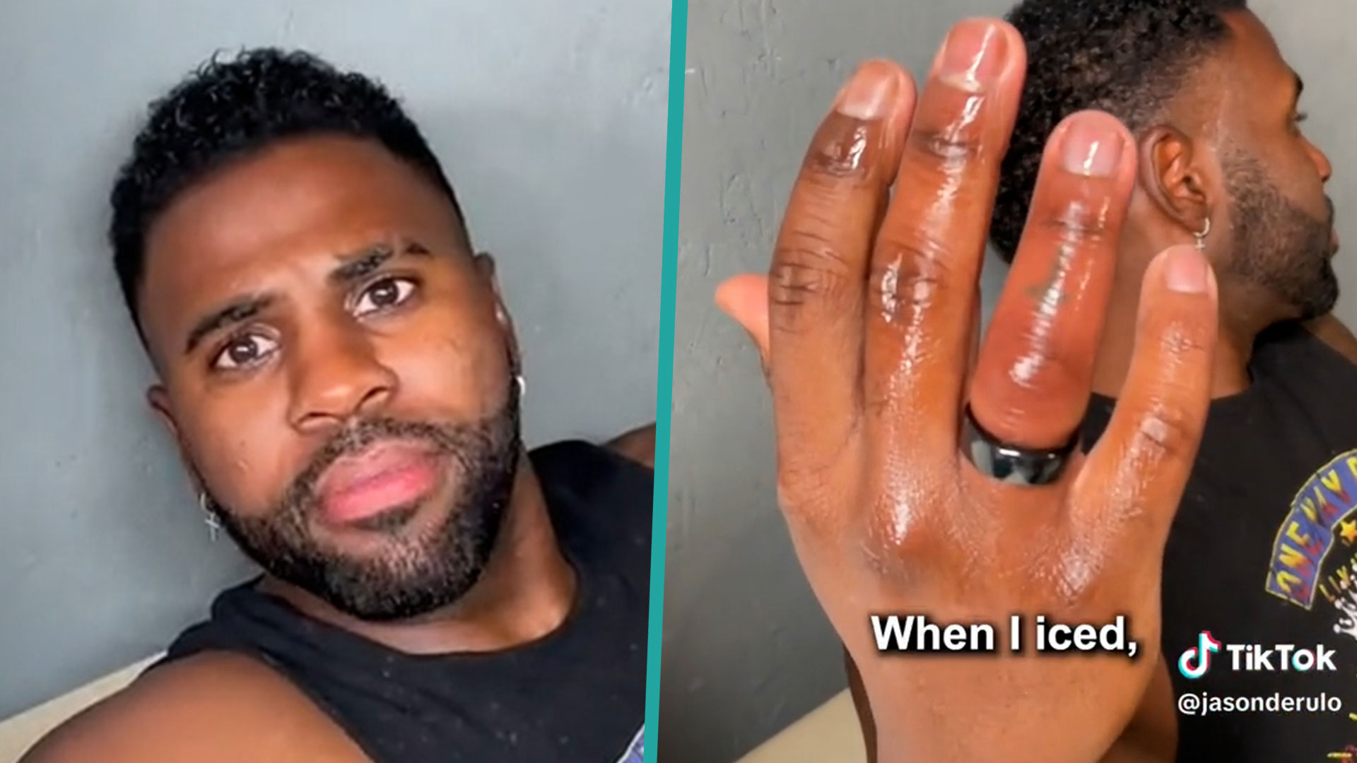 Jason Derulo Rushed To Hospital After A Freak Accident: 'So ...