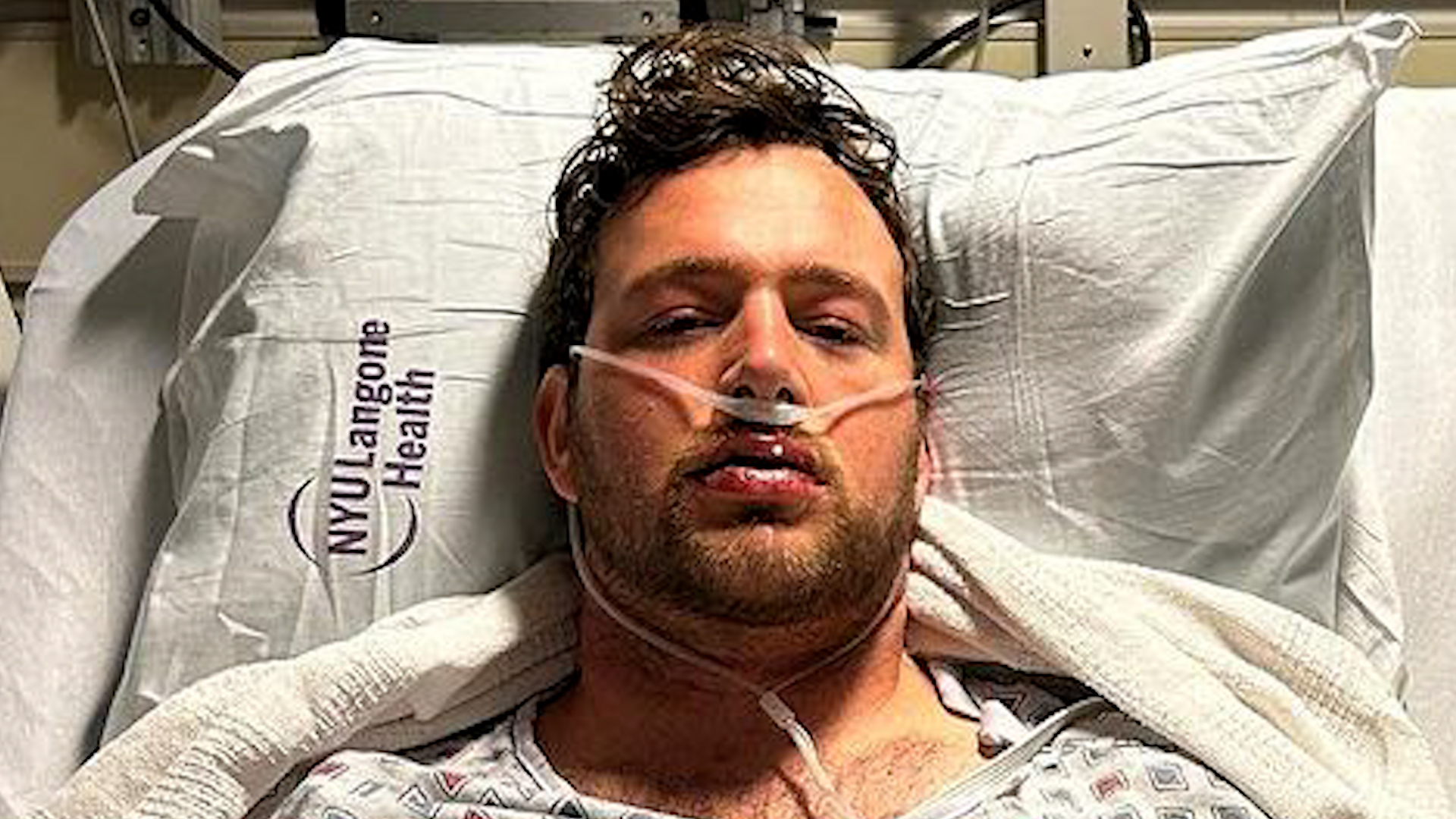 'Below Deck’s' Kyle Viljoen Details ‘Traumatic’ Health Scare & 'Painful ...