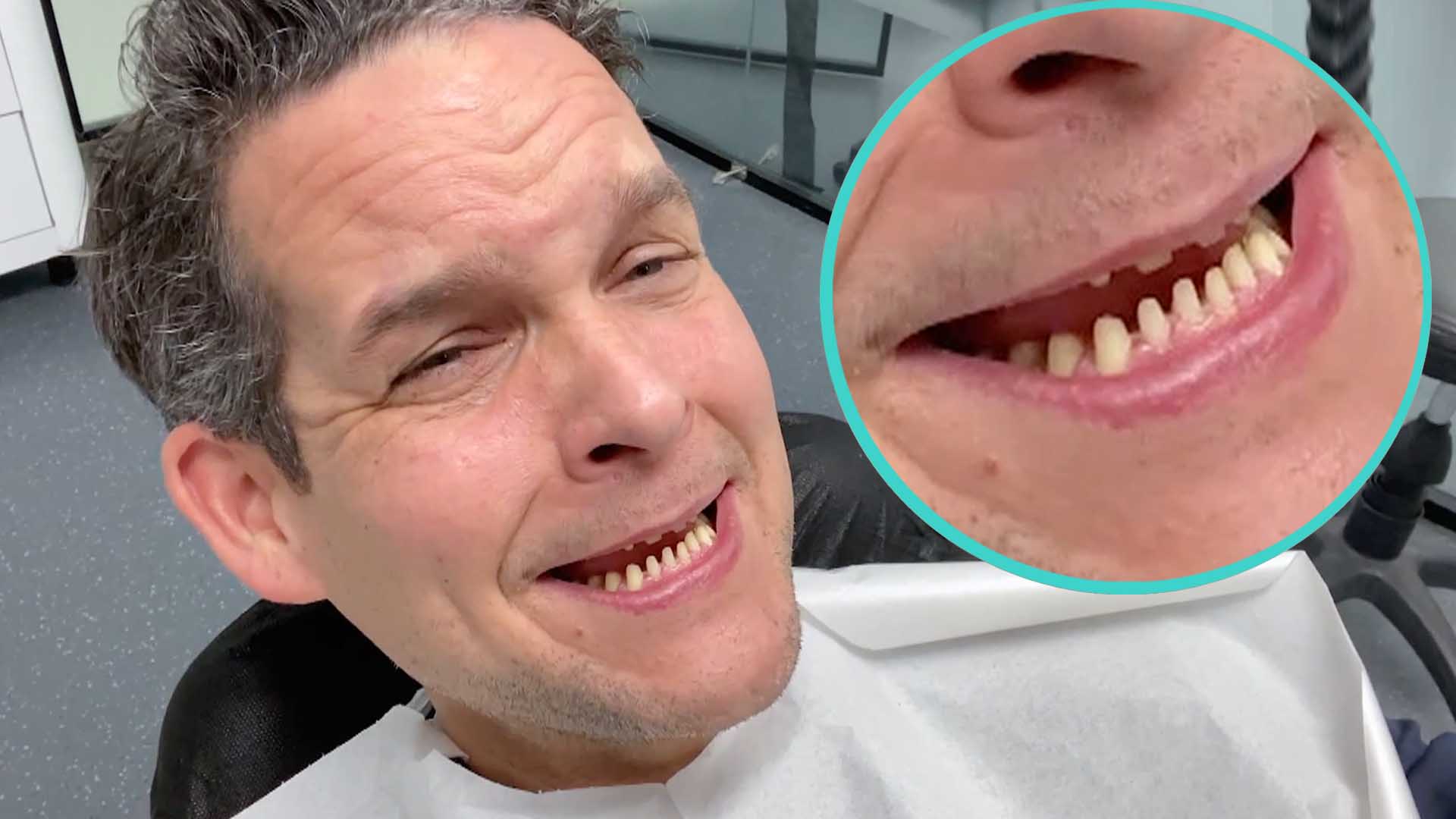 ’90 Day Diaries’: Tom Shocks Mariah With His New Teeth (Exclusive) | Access