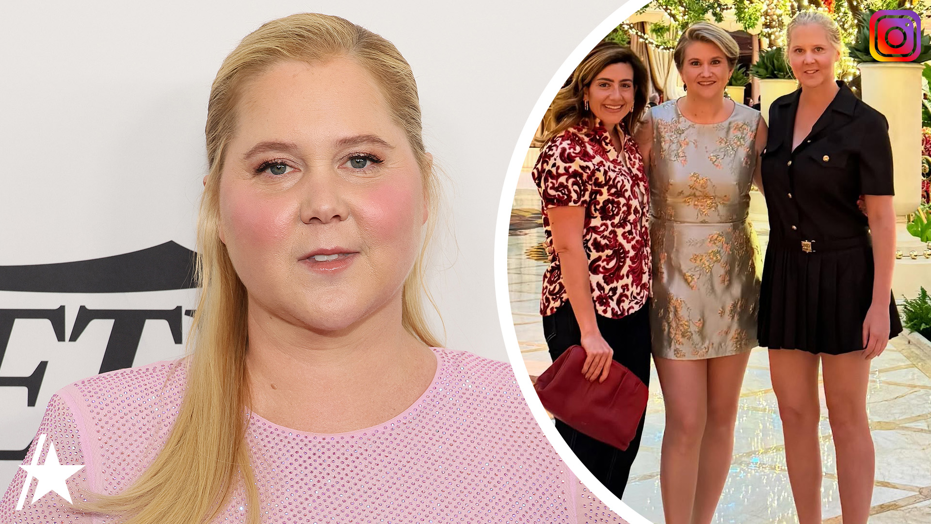 Amy Schumer Reacts To Celebrity Friends Praising Her Body ...